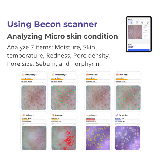 Becon AI Scalp and skin scanner | Revolutionary Scalp Diagnosis Scanner ...