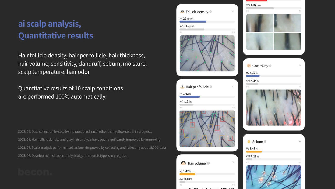 Becon AI Scalp and skin scanner | Revolutionary Scalp Diagnosis Scanner ...